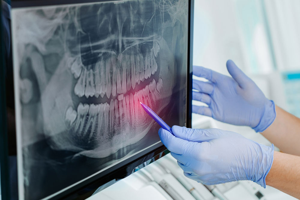 The Evolution of Dental X-Rays in California